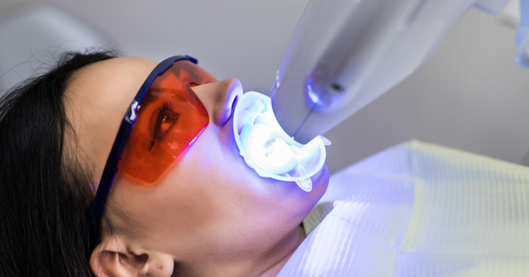Top Techniques for Internal Tooth Bleaching Explained
