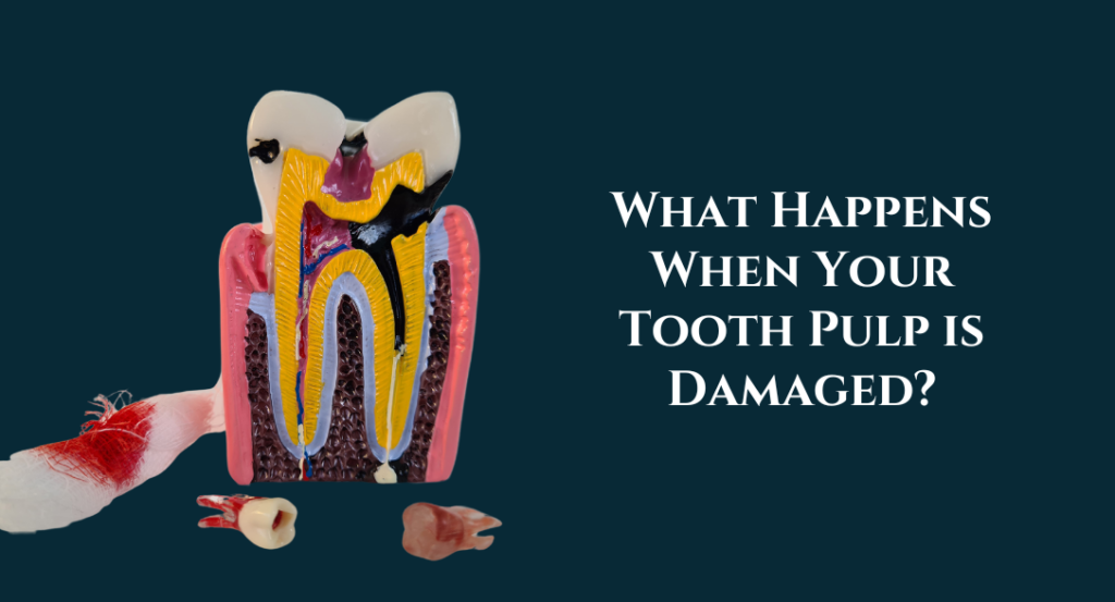 Regenerative Dentistry: Dental Pulp Regeneration Saves Teeth