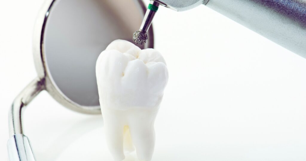What Happens When Tooth Pulp is Damaged?